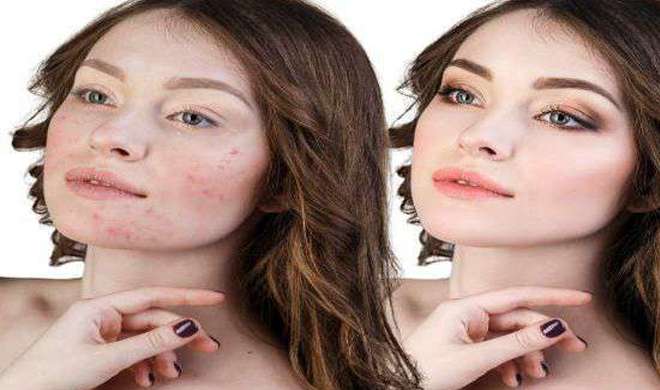 Simple Ways To Remove Red Spots On The Skin: सर्दियों में आपके चेहरे पर ...