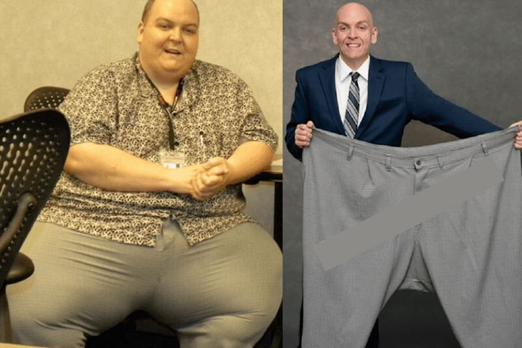 Man refuses surgery he loss 270 pounds with this natural drink - India ...