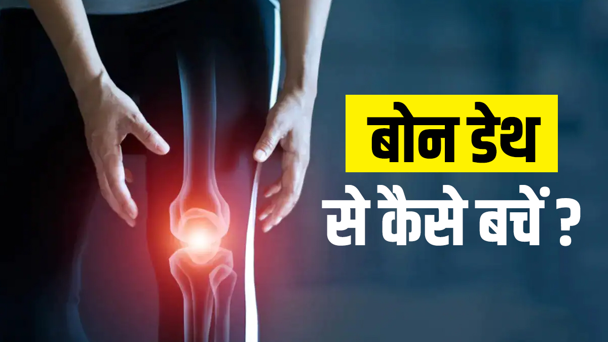 bone death risk increasing adopt these natural remedies to strengthen ...