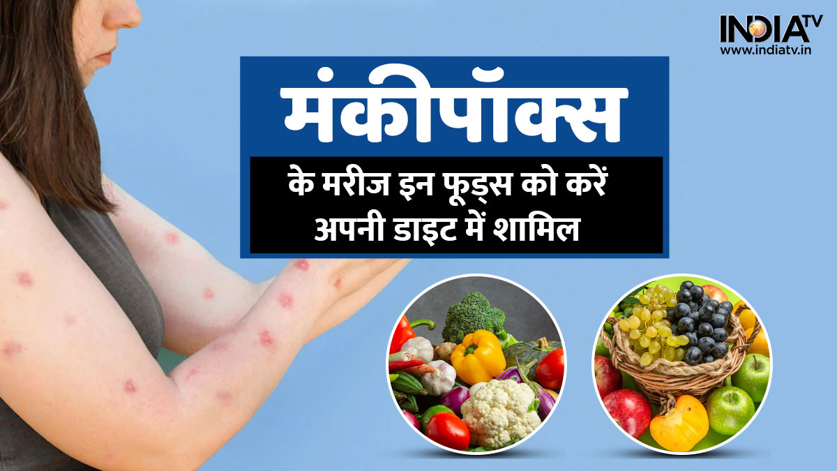 Monkeypox: मंकीपॉक्स के मरीज अपनी डाइट में शामिल करें ये फूड्स, जल्द ...
