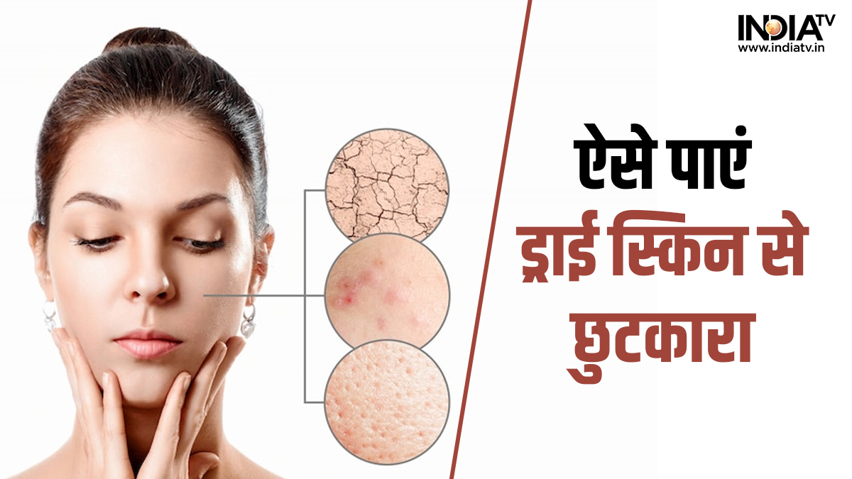 Dry Skin Care: ड्राई स्किन की वजह से चेहरा हो गया है डल, तो फॉलो करें ...