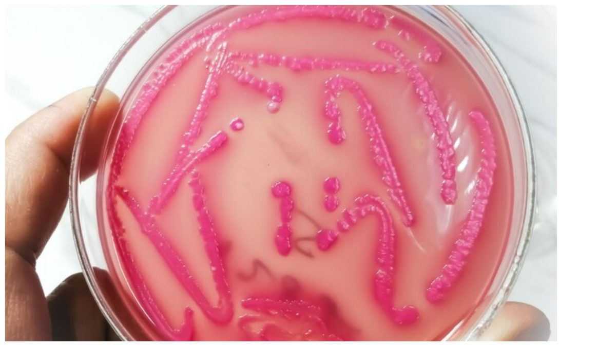 ई कोलाई के लक्षण और कारण | E- Coli Infection causes symptoms in hindi ...