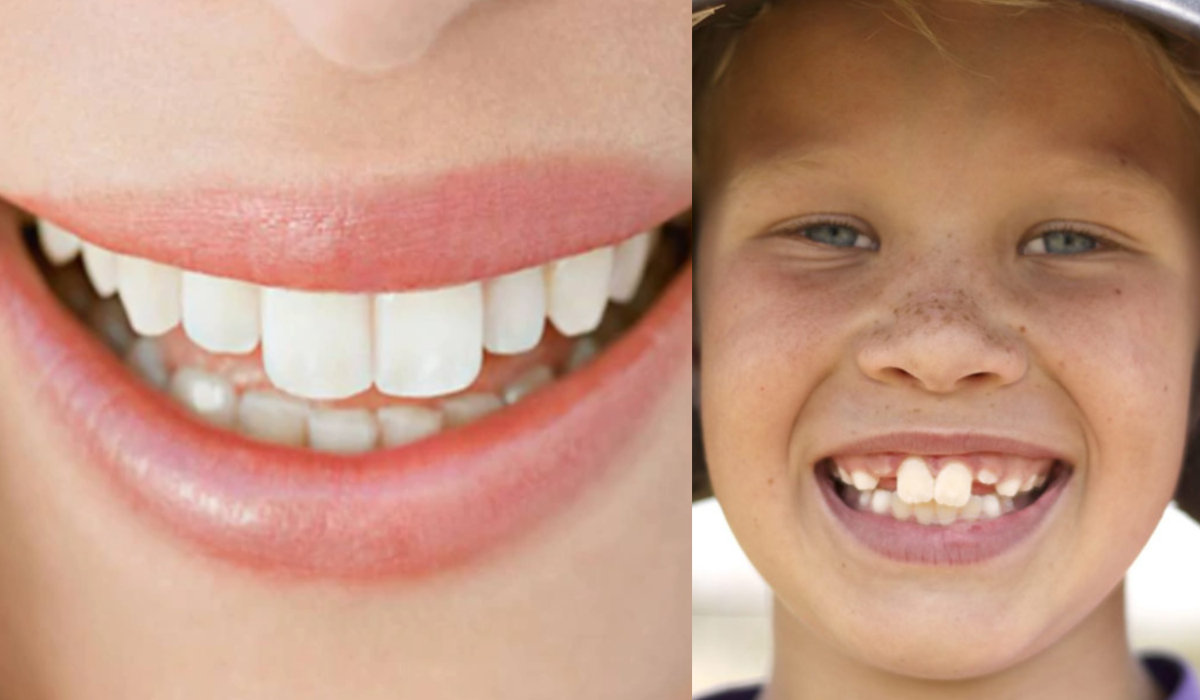 Protruding teeth personality in samudrik shastra मुंह से बाहर की तरफ ...