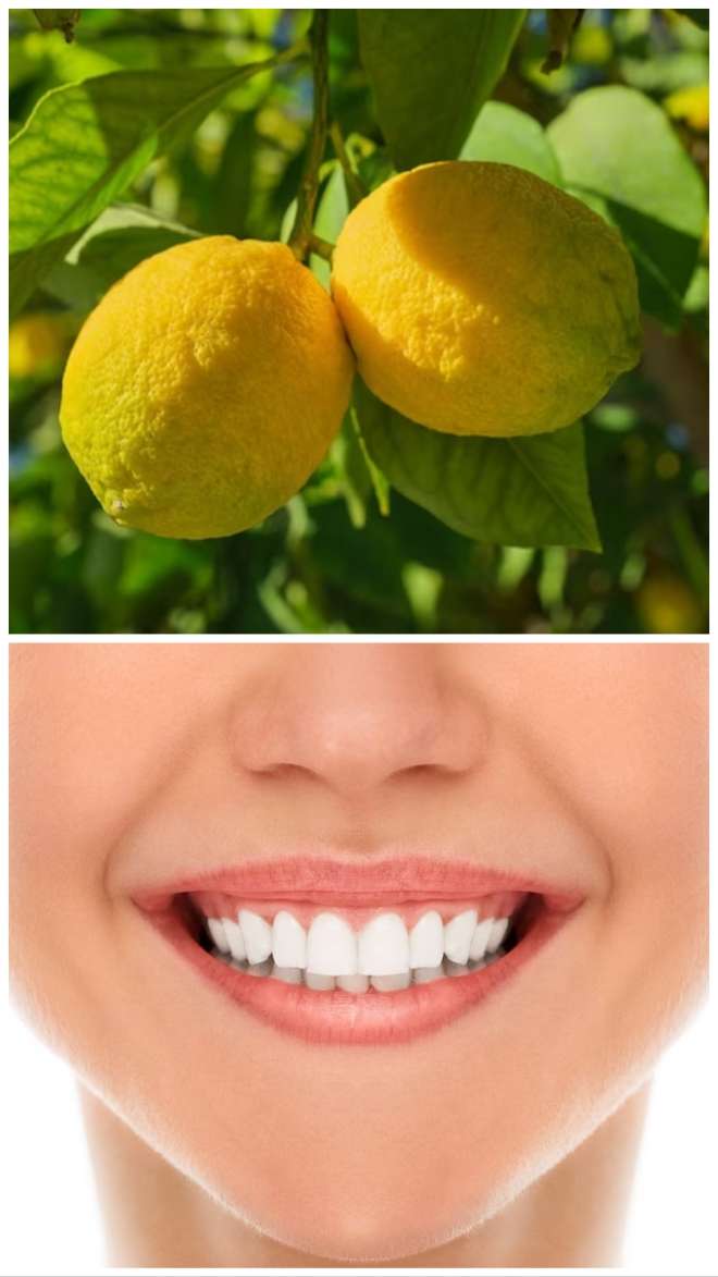 दांतों को कमजोर बनाता है नींबू, जानें इसके नुकसान - India TV Hindi