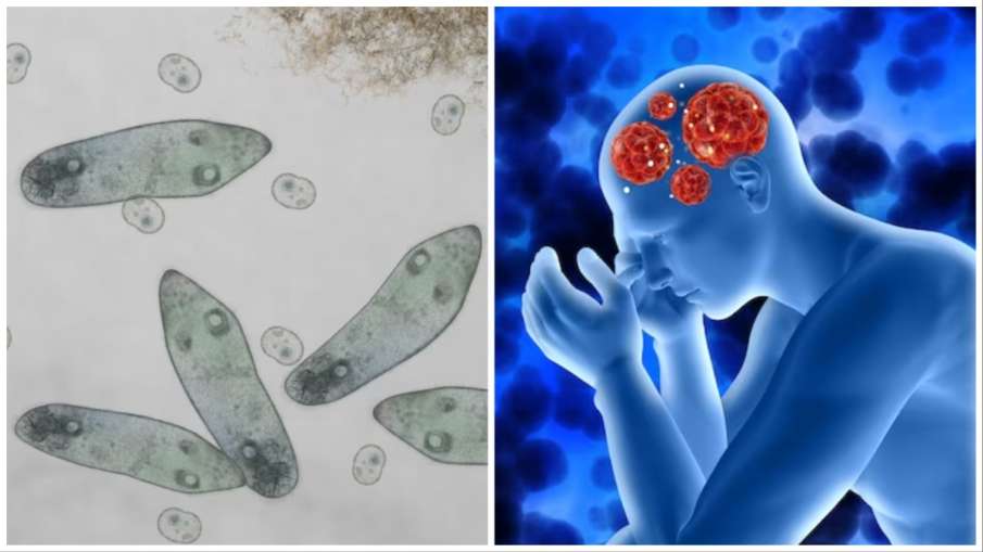 दिमाग खाने वाला अमीबा कहां मिलता है इसकी पहचान और बचाव के तरीके | What ...